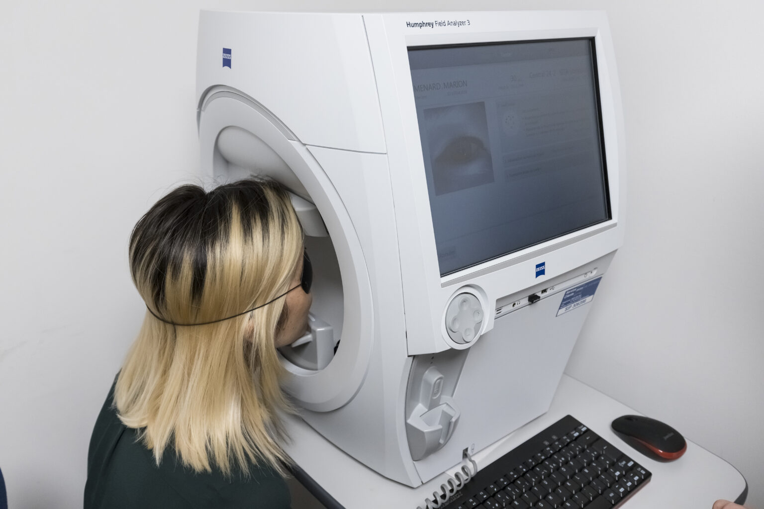 CHAMPS VISUELS - LILLE RETINA VISION